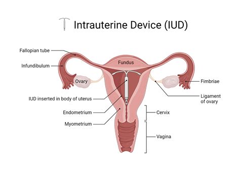 Intrauterine Device Iud Biorender Science Templates
