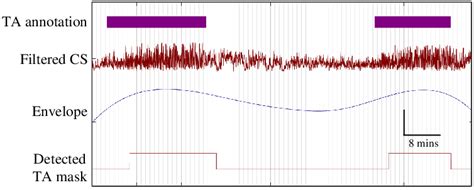 Tracé Alternant Ta Detection Ta Mask Estimated From The Smoothed