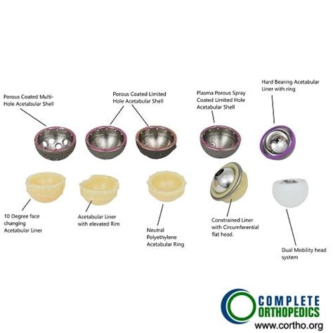 Total Hip Replacement Implants And Surgery Complete Orthopedics