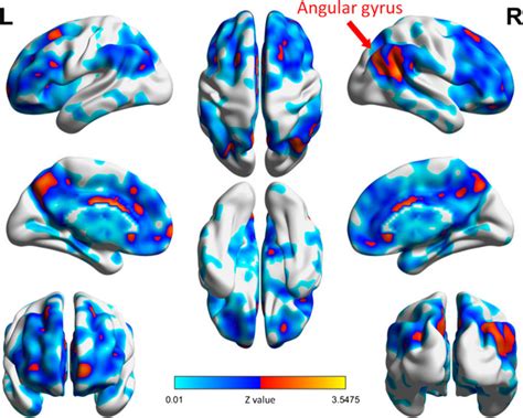 Investigating Sex Related Differences In Brain Structure And Function