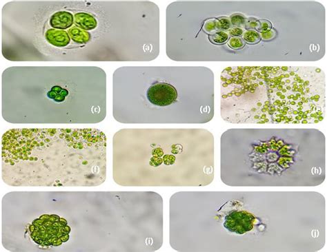 Green Algae Microscope
