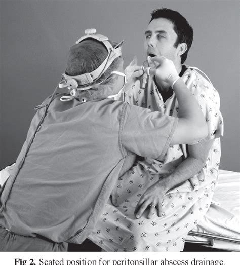 Figure 1 From Novel Technique For Peritonsillar Abscess Drainage