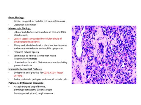 Sinonasal Tract Pathologyhistopathology Pptx
