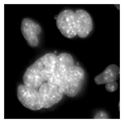 Dapi Counterstained Image Of Contaminated Cells This Fluorescence