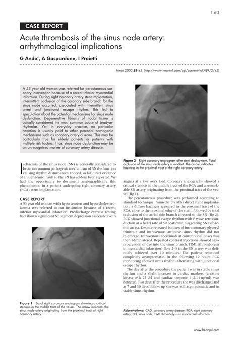 Pdf Acute Thrombosis Of The Sinus Node Artery Arrhythmological Implications