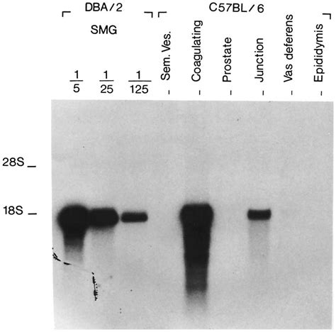 Northern Blot Survey Of Sex Accessory Gland Tissue Twenty Ipg Of Total