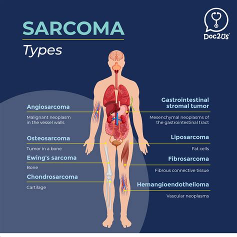 Osteosarcoma Symptoms Nhs