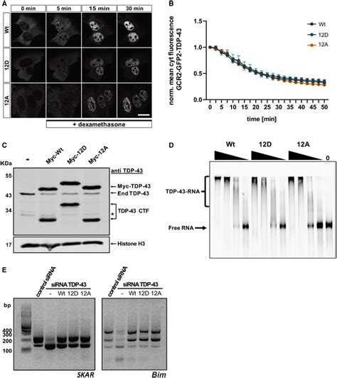 Disease‐linked Tdp‐43 Hyperphosphorylation Suppresses Tdp‐43 Condensation And Aggregation Pmc