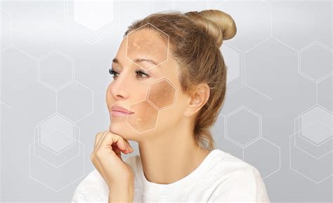 Skin Discoloration Common Causes And Solutions · Conway Medical Center