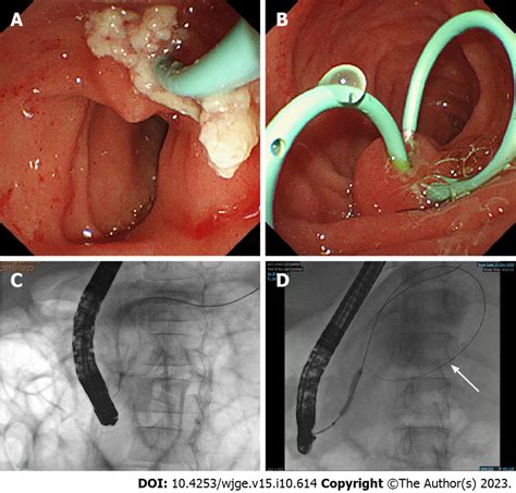 Endoscopic Retrograde Cholangiopancreatography Procedures A Download Scientific Diagram
