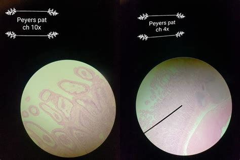 Peyers Patch Diagram Quizlet