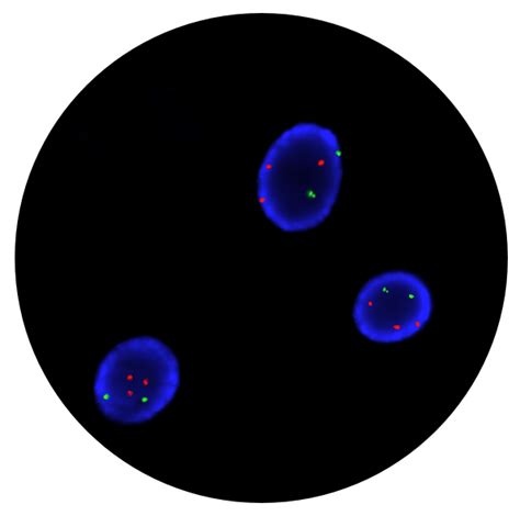 CytoCell FAST FISH Prenatal X Y 13 18 21 Probe Kit OGT