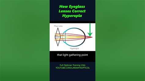 How Lenses Correct Hyperopia Youtube