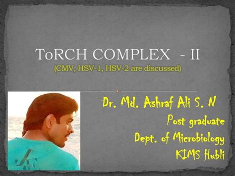 Lab Diagnosis Of ToRCH Complex PPSX