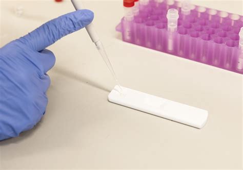 Clinical Trials With Lateral Flow Tests Key Considerations