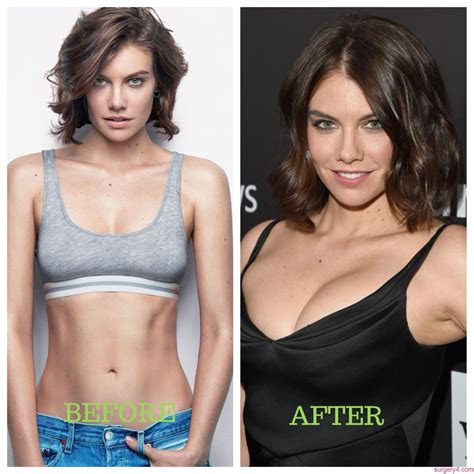 Lauren Cohan Breast Implants Photos Before And After Surgery4