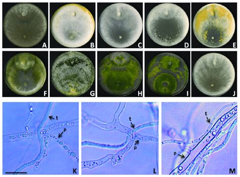 Mycoparasitism Of Trichoderma Strains Against P Cinnamomi In Dual Download Scientific Diagram