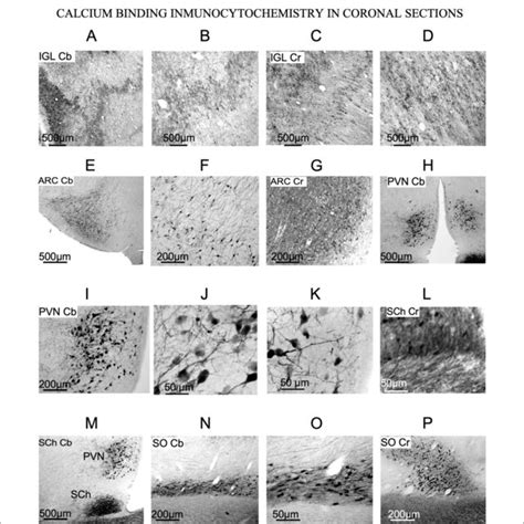 Figure Calcium Binding Protein Immunoreactivity Of The Nuclei Of