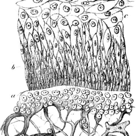 Gross A And Microscopic Appearance B Of Warthin Tumor Described In Download Scientific