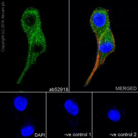 Anti Ngf Antibody Ab216419 Abcam