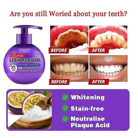 Baking Soda Toothpaste Stain Removal Whitening Toothpaste Fight