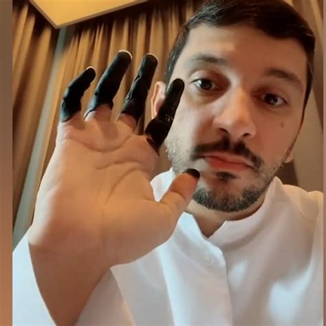 Severe Frostbite Everest