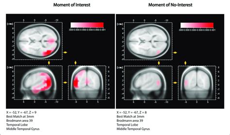 Loreta Source Localization Results The Left Panel Shows Localization