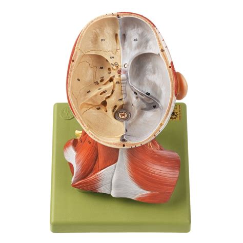 Somso Head Model With Muscles And Vessels