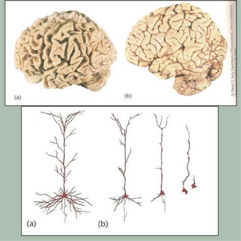 Module 15 Learning And Memory Flashcards Quizlet