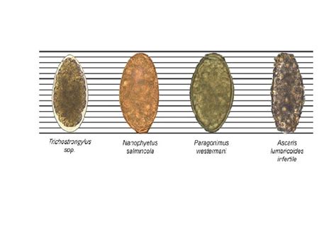 Trichostrongylus Spp Strongyloides Stercoralis Oleh Nurhalina M Epid