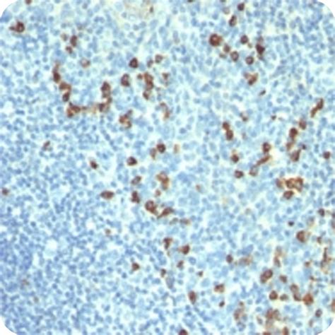 Lambda Light Chain B Cell Marker Clone Hp6054 Concentrate