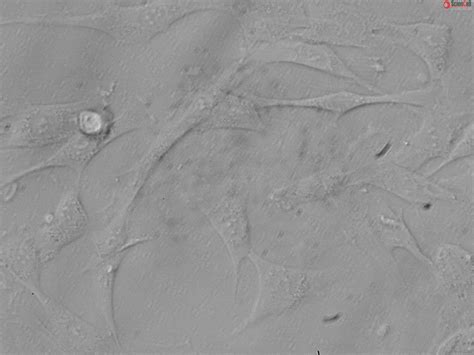 Human Hair Follicle Outer Root Sheath Cells Hhforsc