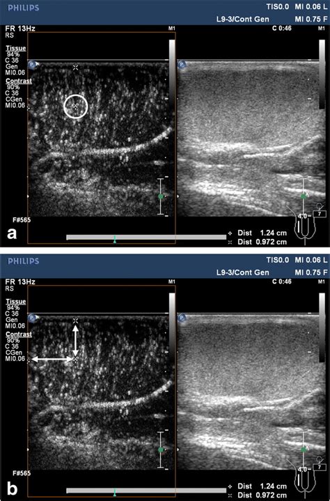 The Best Perfusion Area Analysis And Location A The Best Perfusion Download Scientific