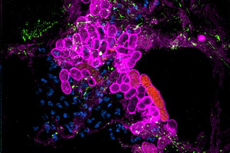 Winning ‘battle For Metals Key To Defeating Antibiotic Resistant