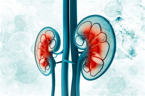 Risk Factors For Scleroderma Renal Crisis In Systemic Sclerosis Rheumatology Advisor
