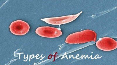 Anemia Market Health Beauty