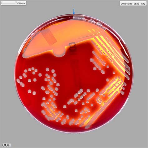 High Risk Samples Black Country Pathology Services