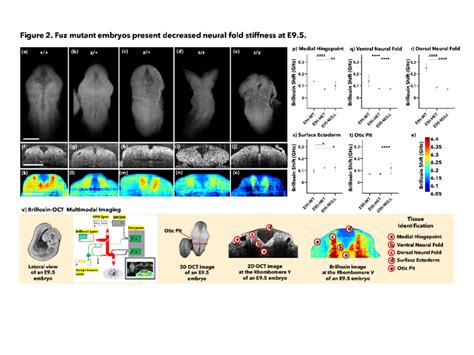 Fuz Mutant Embryos Present With Decreased Neural Fold Stiffness At E9 5