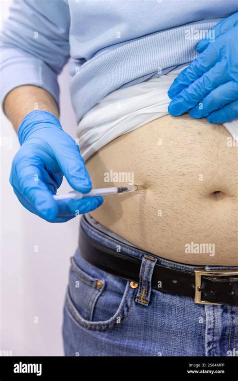 How To Properly Give Yourself Subcutaneous Injection In Your Stomach Concept Cropped Photo Of A