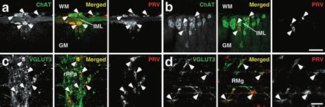 Retrograde Transneuronal Labeling With Prv Inoculated Into The Download Scientific Diagram