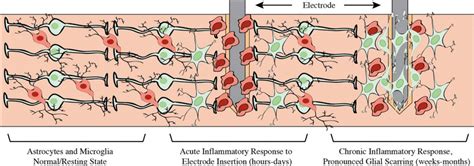 1 Schematic Of Glial Scar Formation Microglia Cells Red First Download Scientific Diagram