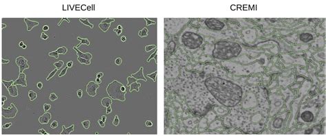 Vim Unet Vision Mamba For Biomedical Segmentation
