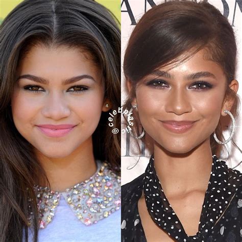 Zendaya Antes De Las Cirugías Así Fue Su Transformación