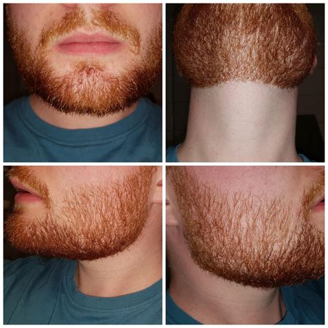 20 Yo 4 Weeks Beard Do You Think It Has Potential And What Style Can