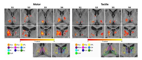 Functional Mapping Of Sensorimotor Activation In The Human Thalamus At 94 Tesla