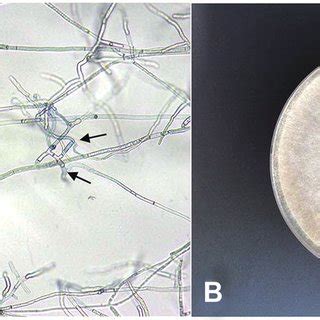 Anastomosis Test Of Rhizoctonia Solani Isolate From Coastal Hogfennel