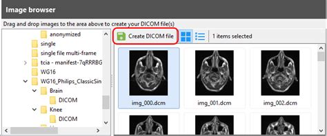 Converting Images To Dicom Files