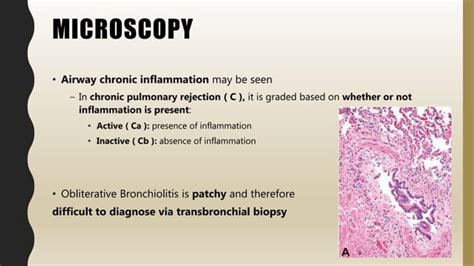 Flashpath Lung Constrictive Obliterative Bronchiolitis Ppt