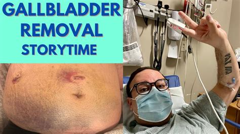 Gallbladder Surgery Recovery Tips For A Speedy Healing Journey