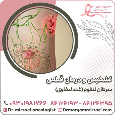 تشخیص و درمان قطعی سرطان لنفوم غدد لنفاوی دکتر میرزایی مقدم